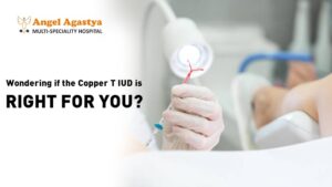 Copper T IUD Your Comprehensive 3 Step Guide to